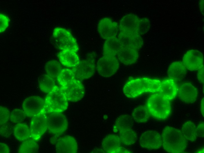 Überblick Rickettsiose - Parasitus Ex e.V.